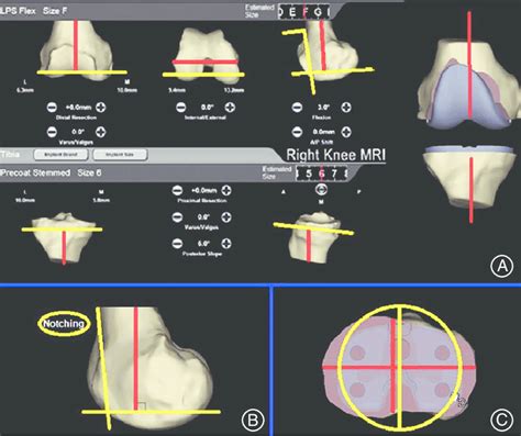 Adapted User Interface Showing The Data Necessary For Preoperative Download Scientific Diagram