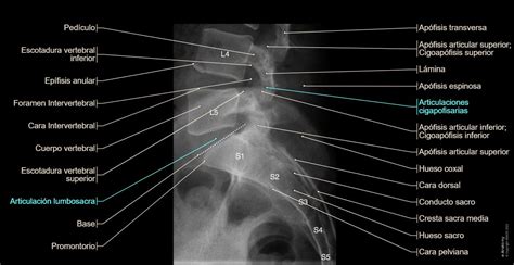 Radiografía De La Articulación Sacroilíaca Normal