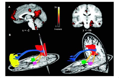 Functional Connectivity Reflects Structural Connectivity In The