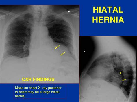 Ppt Gastrointestinal Imaging Powerpoint Presentation Free Download