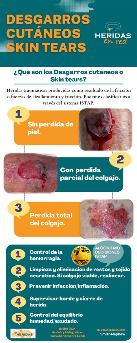 Infografía Desgarros Cutáneos Heridas En Red