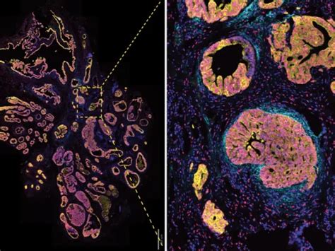 Pathologists Worldwide Join Forces To Tackle Mitotic Figure