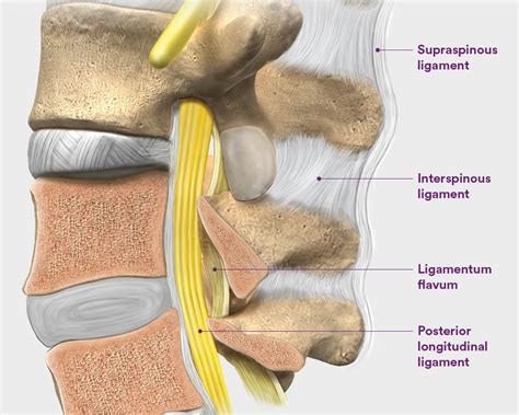 Supraspinous Ligament Cadaver