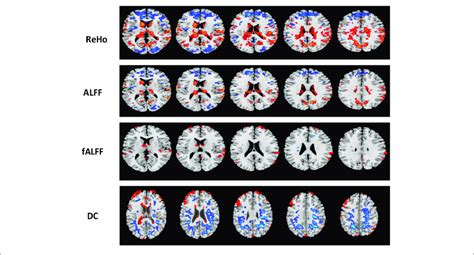 Univariate T Test Difference Maps Between Two Classification Groups