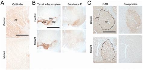 A Immunoreactivity For Calbindin In The Dorsal Striatum Of Control