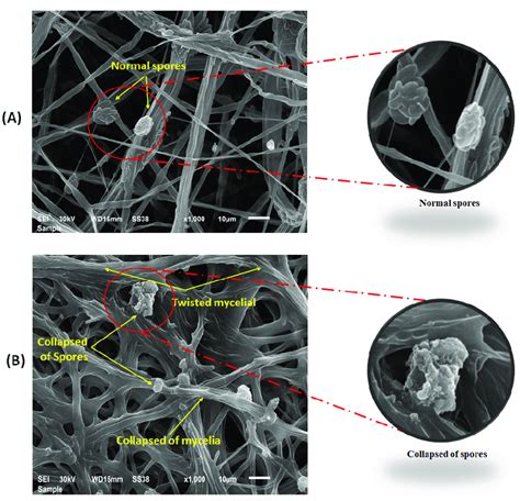 Light Microscope Observation Of Spores Of F Solani Showing A