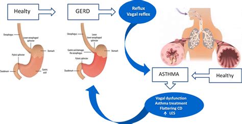Gerd Guidelines 2018 Pdf Gerd Foods To Avoid