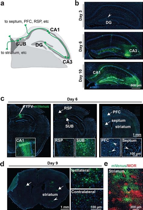 Transneuronal Spreading Of Yfv 17d In Hippocampal Pathways Athe