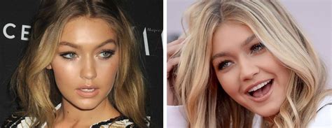 Does Gigi Hadid Have Plastic Surgery Verge Campus