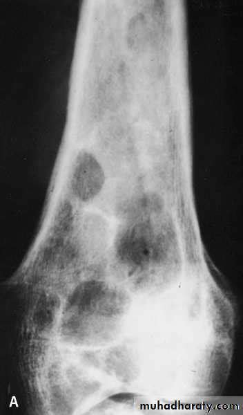 Cestodes Echinococcus Granulosus Pptx عملي Muhadharaty