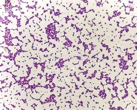 Is Staphylococcus Epidermidis Gram Negative