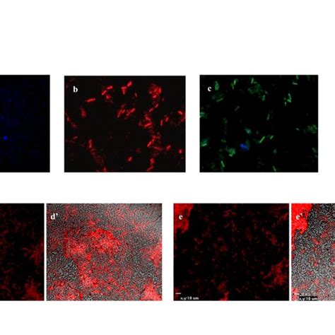 The Scheme Of Mixed Acid Fermentation Escherichia Coli Type The