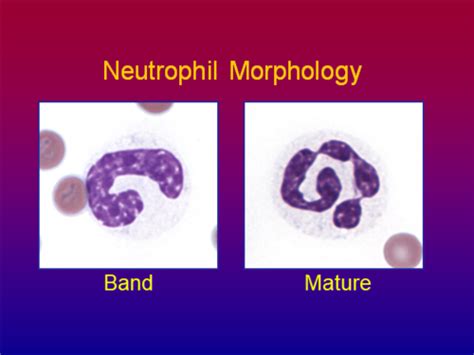 Lecture 14 Leukocytes Morphology Kinetics And Function Flashcards