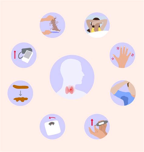 Identifier Lhyperthyroïdie Redcare Pharmacie