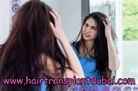 Abiaamir Giphymaker Hair Loss In Women 