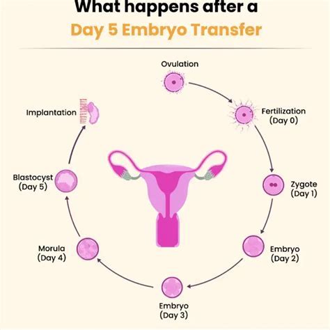 How To Stay Pregnant After Frozen Embryo Transfer