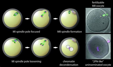 Zuzana Holubcova On Linkedin On The Importance Of Oocyte Spindle Pole
