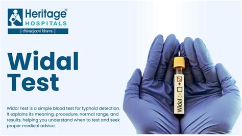 What Is Widal Test Meaning Procedure And Normal Range