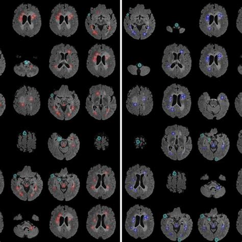 Summary Of Computational Analysis Over Real Mri Database Download