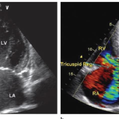 Cipp Model By Stufflebeam Cipp Evaluation Model Is Recommended As A Download Scientific Diagram