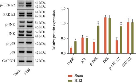 Irf 1 Promoted Inflammatory Response And Apoptosis In H R Exposed