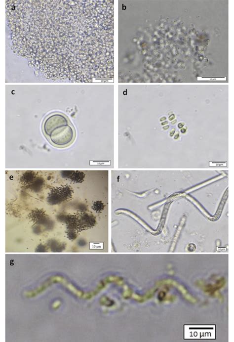 Cyanobacteria A Aphanothece Floccosa B Gloeothece Subtilis C Download Scientific Diagram
