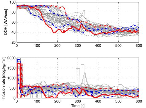 Recorded Closed Loop Controlled W Av Cns And Propofol Infusion Rate For Download Scientific
