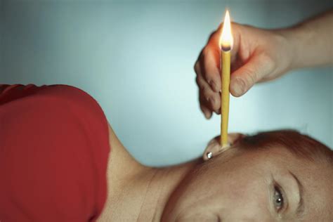 How Do Earwax Candles Work The Importance Of Professional Ear Wax