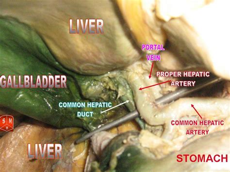 Gallbladder Surgeryis It Really Necessary Mountain Grannys