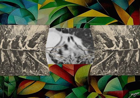 Lungs Bronchi Traction Bronchiectasis Subpleural Sparing Volume Loss