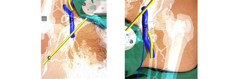 screen capture of augmented reality assisted surgery system developed