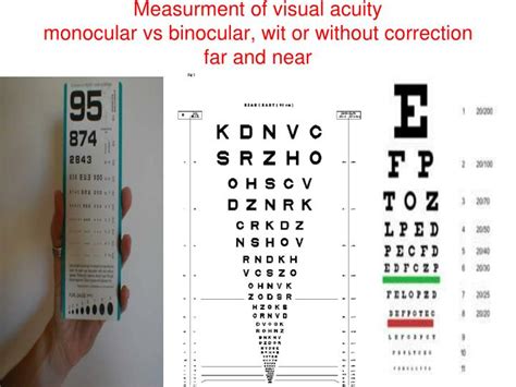 Ppt Clinical Eye Examination History And Physical Examination