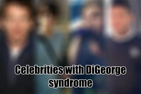 Redefining Success Inspiring Celebrities With Digeorge Syndrome Otakusnotes