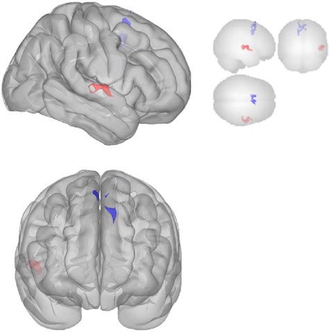 Significant Clusters For The Medial Prefrontal Cortex Mpfc Download Scientific Diagram