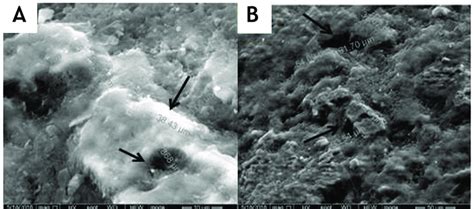 Sem Microstructure Of Tooth Enamel Without The Application Of Apf Gel