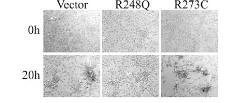 Detection Of Apoptotic Cells By Tunel Analysis Following Dox Treatment Download Scientific