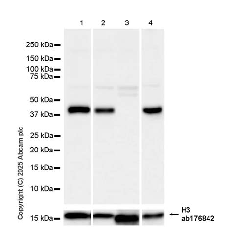 Anti Histone H3 抗体 [epr16987] Nuclear Marker And Chip Grade Ab176842