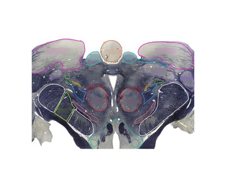 Forebrain Diencephalon Identification Diagram Quizlet
