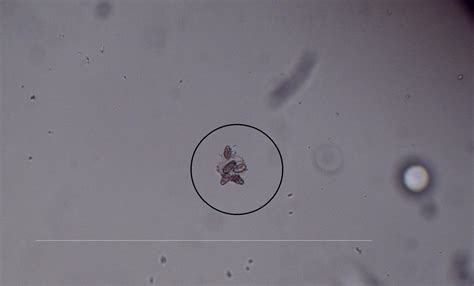 Clonorchis Sinensis Egg Parasitology