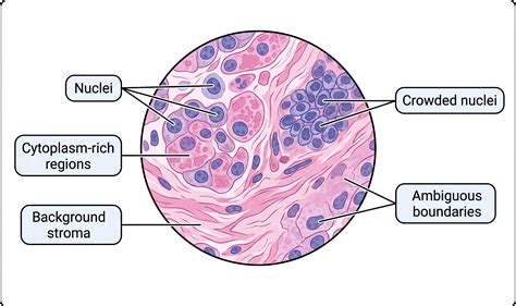 Hande Nuclei Segmentation — A Practical Review Bioinformaniac