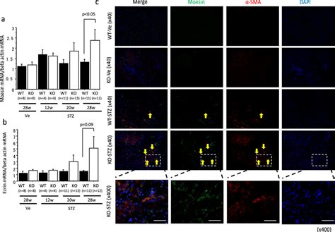 Moesin Co Expressed On α Sma Positive Cell Expression Of Moesin And Download Scientific