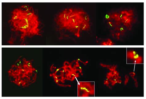 Leptotene To Diplotene Like Stages In An F1 Wheat Rye Hybrid Rye