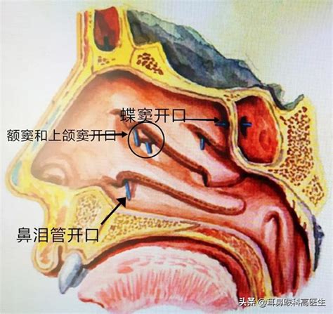 本人慢性鼻窦炎三个月治愈计划 知乎