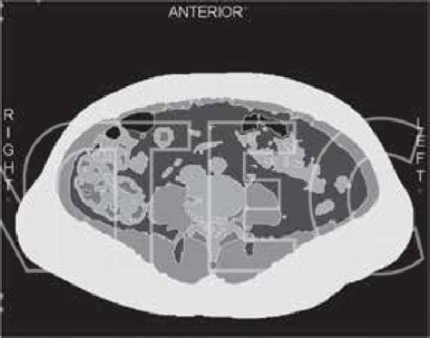 Example Of Ct Scan Analysis By The Slice O Matic Software Lumbar Download Scientific Diagram