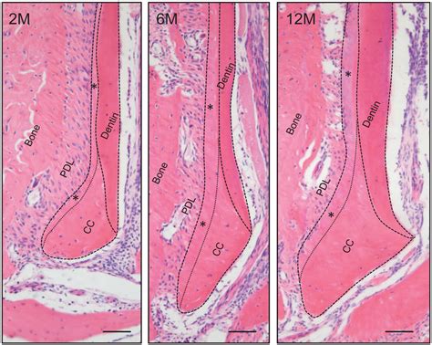 Periodontal Membrane Histology