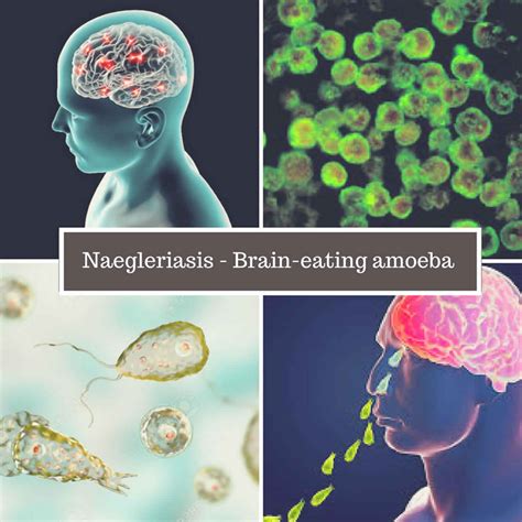 Primary Amebic Meningoencephalitis