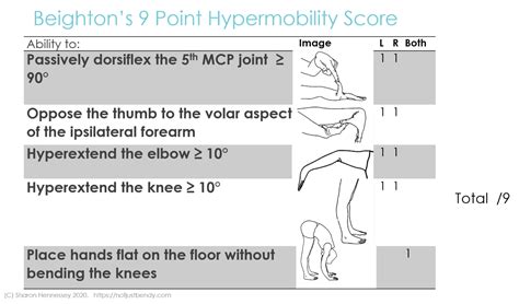 Hypermobility Brisbane Physiotherapy