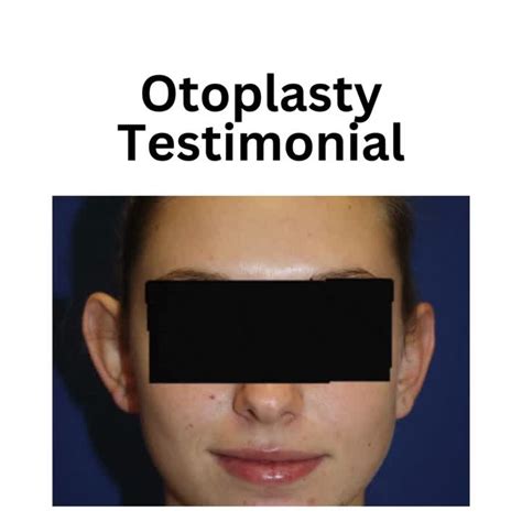 Nathan Eberle On Linkedin Otoplasty Plasticsurgery