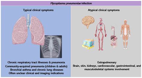 Mycoplasma Pneumonia Contagious Qgwr
