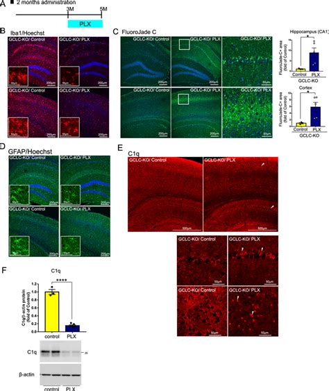 Synaptic Pruning By C1q Is Involved In The Reduced Volume Of Gclc Ko Download Scientific